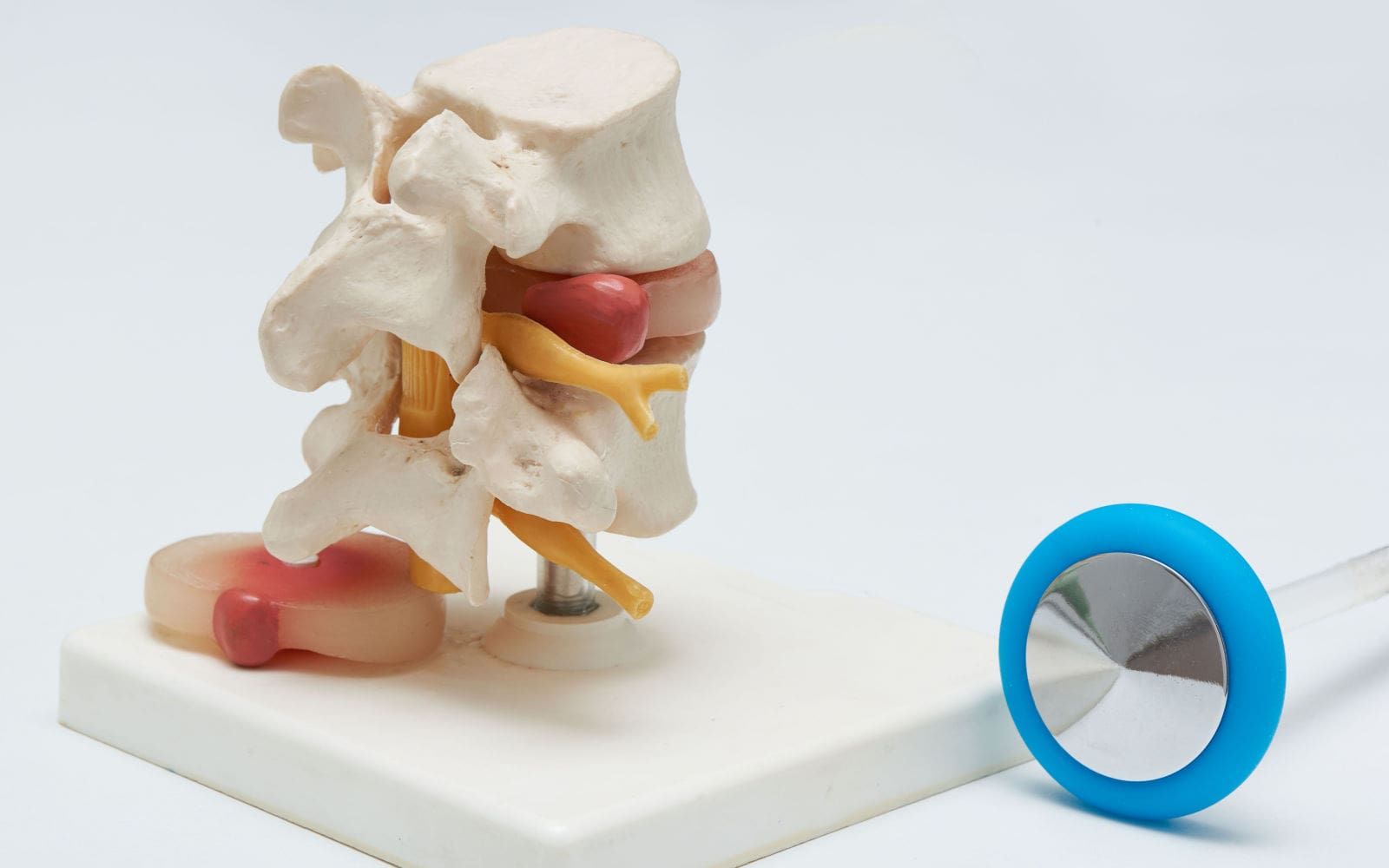 Your Options For Permanent Solutions For Back Pain - Delaware Valley ...